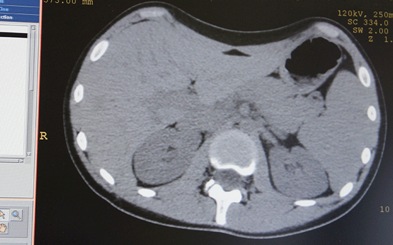 TAC-ADDOME - Salucom